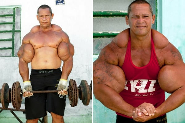 What is Synthol and it's side effects? — MO Marketplace