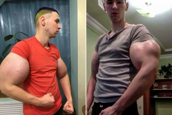 What is Synthol and it's side effects? — MO Marketplace