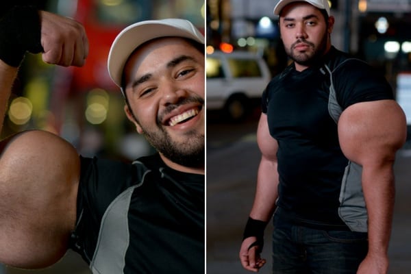 What is Synthol and it's side effects? — MO Marketplace