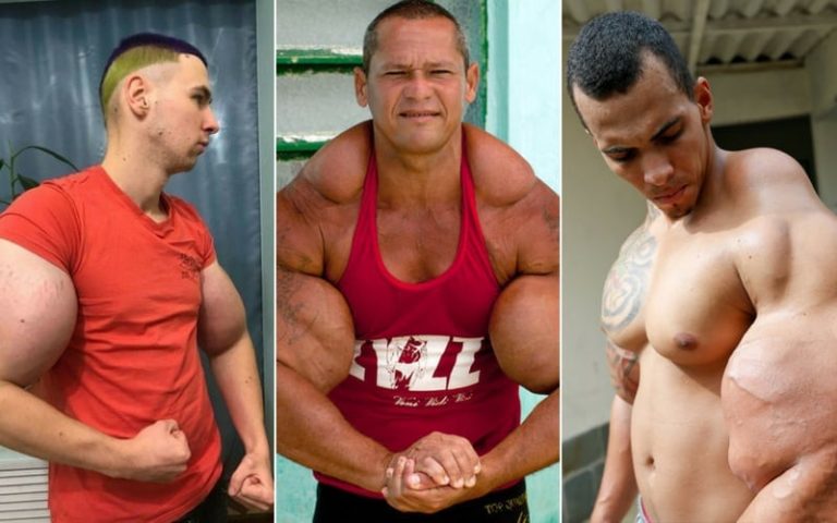 What is Synthol and it's side effects? — MO Marketplace